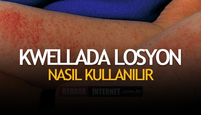 Kwellada Losyon Nasıl Kullanılır?